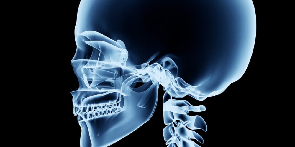 87 TEMPORAL BONE DISSECTION WORKSHOP | SBORL | Sociedad Balear de ...